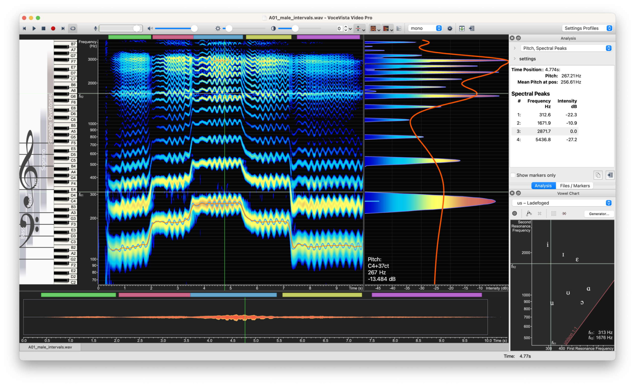 VoceVista Video - Universal Voice Institute